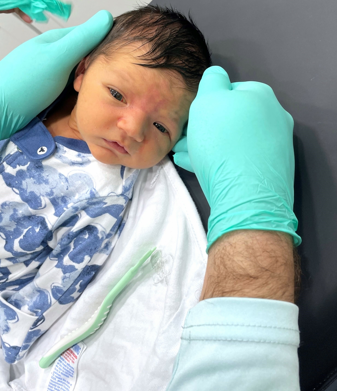 Tongue & Lip Ties ⋆ Belpre Dental Studio®