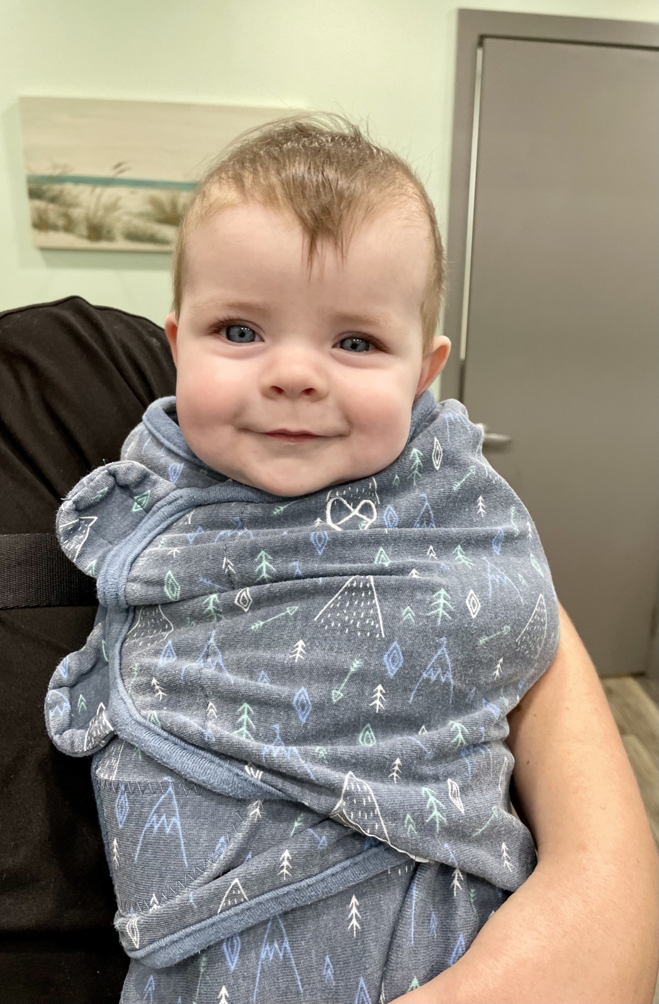 Tongue & Lip Tie Gallery ⋆ Belpre Dental Studio®